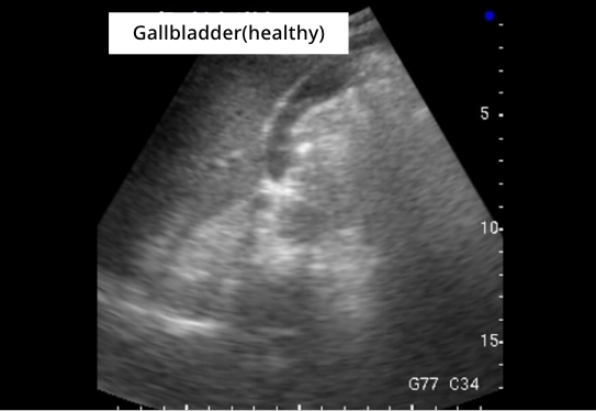 Pocket-sized Ultrasound Imaging Device miruco - SIGMAX