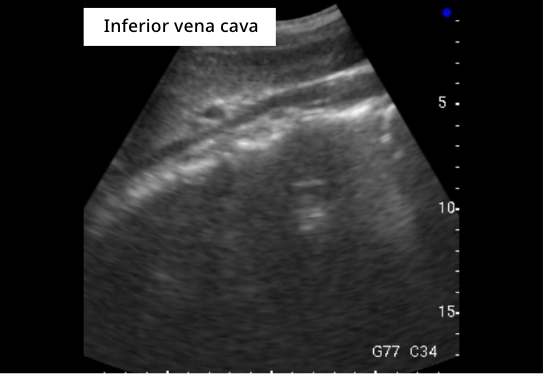 Pocket-sized Ultrasound Imaging Device miruco - SIGMAX