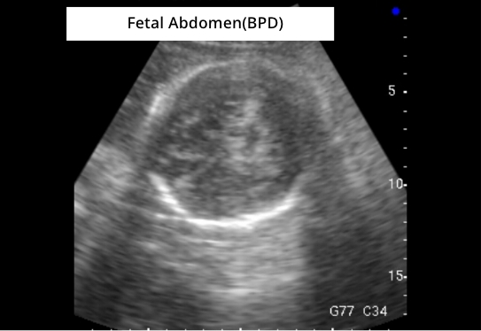Pocket-sized Ultrasound Imaging Device miruco - SIGMAX