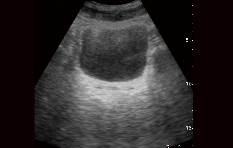 Pocket-sized Ultrasound Imaging Device miruco - SIGMAX