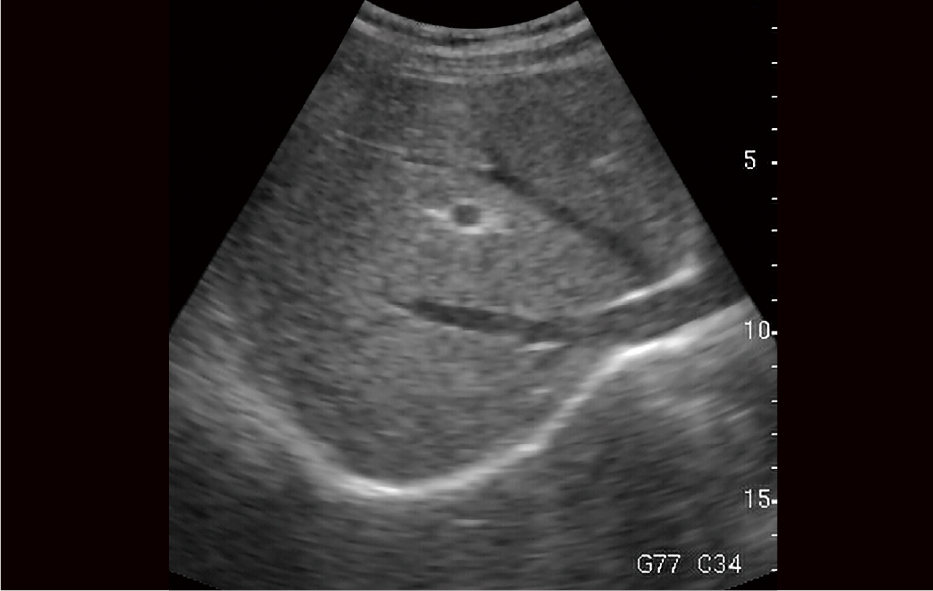 Pocket-sized Ultrasound Imaging Device miruco - SIGMAX