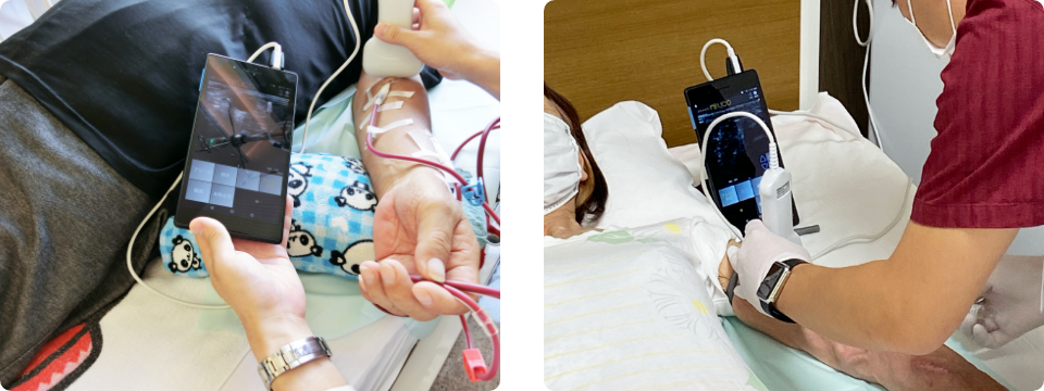 Pocket-sized Ultrasound Imaging Device miruco - SIGMAX