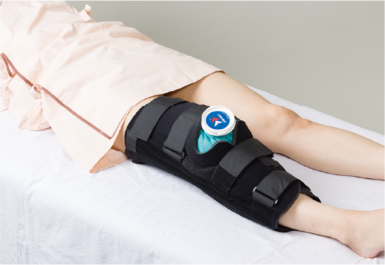 Hybrid Splint - SIGMAX